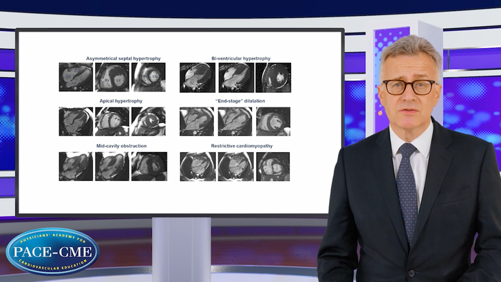 CME: HCM: Understanding the condition - PACE-CME