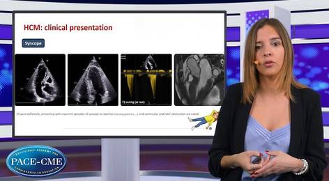 Hypertrophic cardiomyopathy & heart failure: exploring new options ...