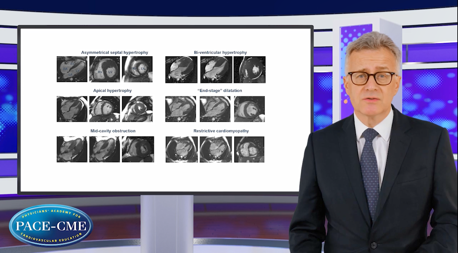 CME: HCM: Understanding the condition - PACE-CME