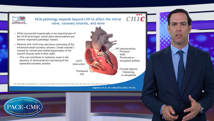 CME: Diagnostic challenges for symptomatic obstructive HCM - PACE-CME