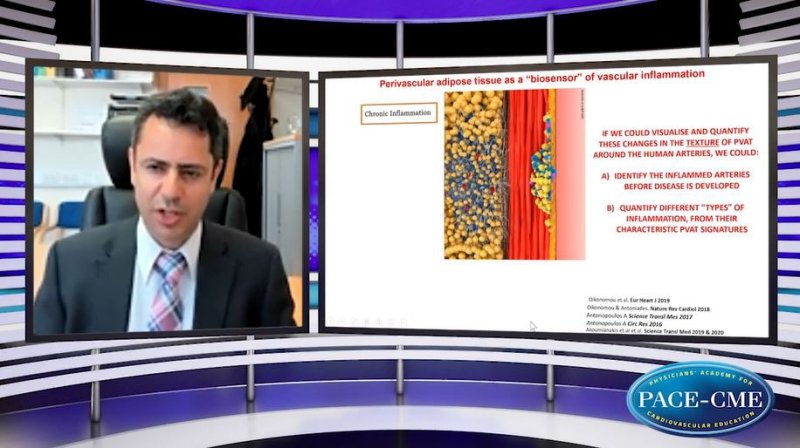 Detecting residual cardiovascular risk using coronary CT angiography ...