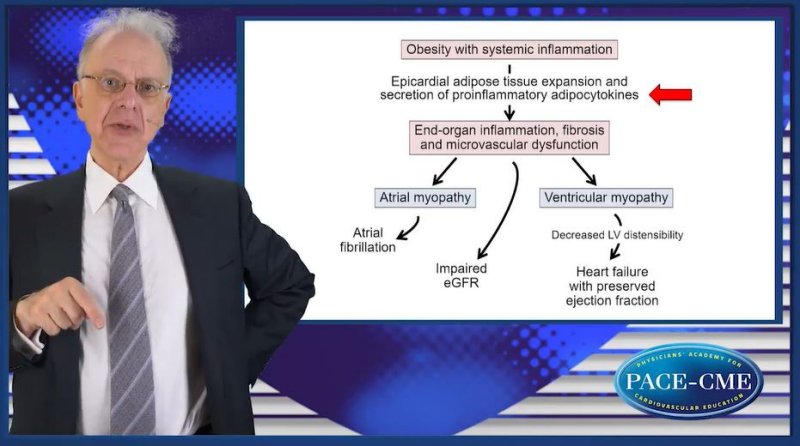 Understanding and managing obesity-related HFpEF - PACE-CME